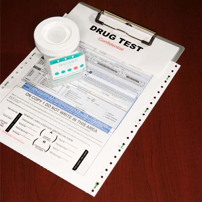 How Long For LabCorp Drug Test Urine Results Inmateseducation